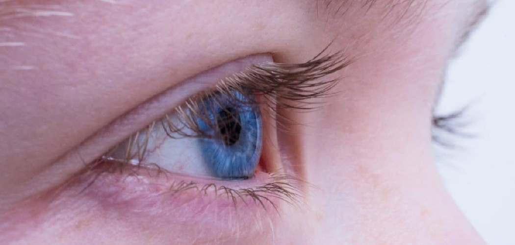 How to Get Rid of Excess Skin on Eyelids | Beneficial 7 Tips