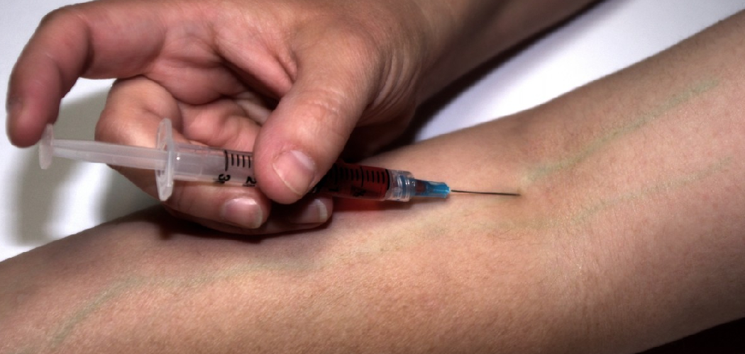 How to Get Broken Needle Out of Skin | 10 Effective Ways