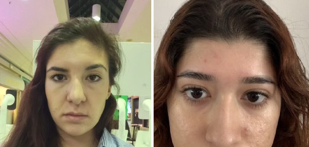 How to Fix Asymmetrical Eyebrows | 10 Easy Methods (2025)