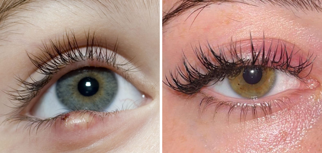 How to Get Rid of a Stye With Eyelash Extensions | 10 Easy Steps