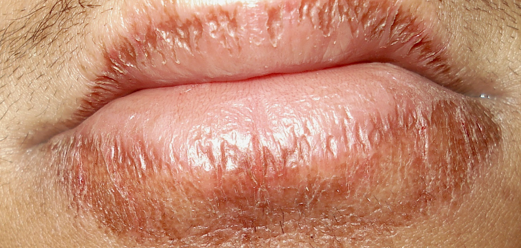 How to Stop White Line on Lips | (2026)
