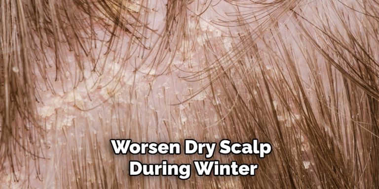 How to Fix Dry Scalp in Winter | 10 Easy Steps (2026)